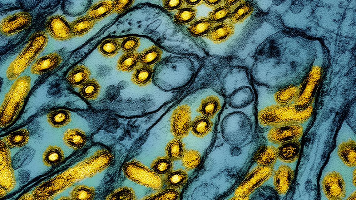 CDC confirms 1st human case of bird flu in Oregon | kgw.com