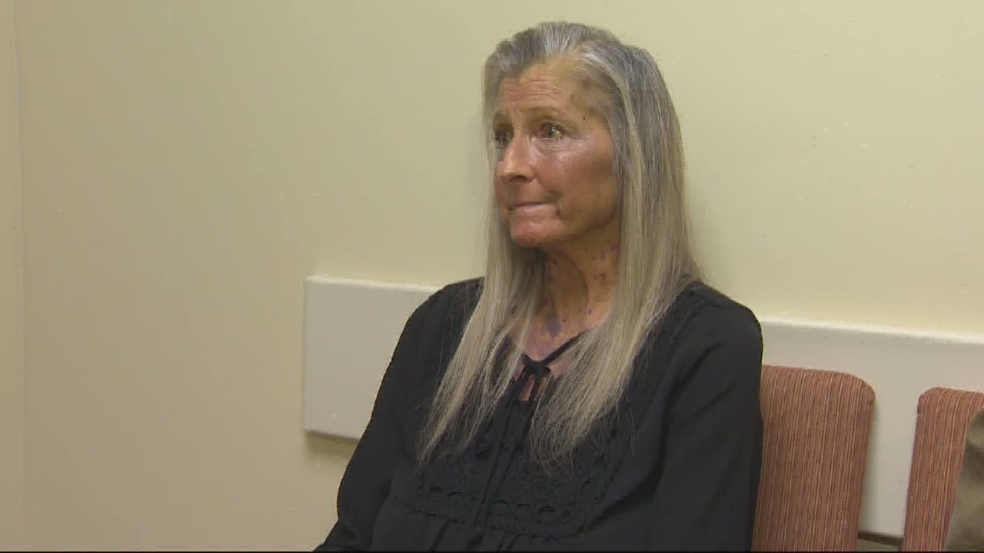 Oregon 'dropped head syndrome' patient receives liver transplant | kgw.com