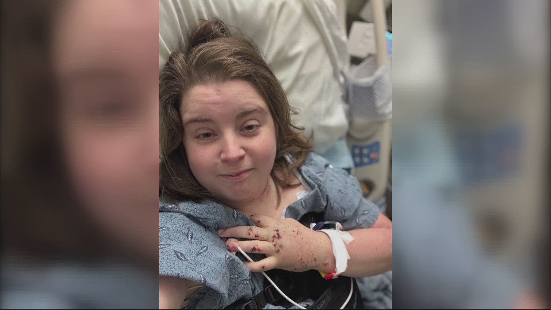 Vancouver woman's life changes after crash injury | kgw.com