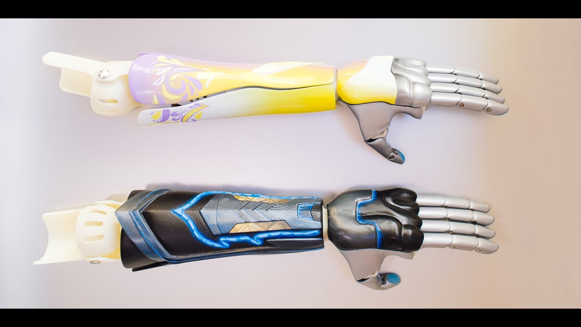 Photos: 3D printed bionic arms | kgw.com