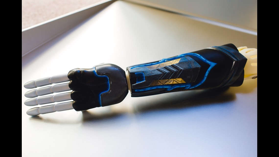 Photos: 3D printed bionic arms | kgw.com