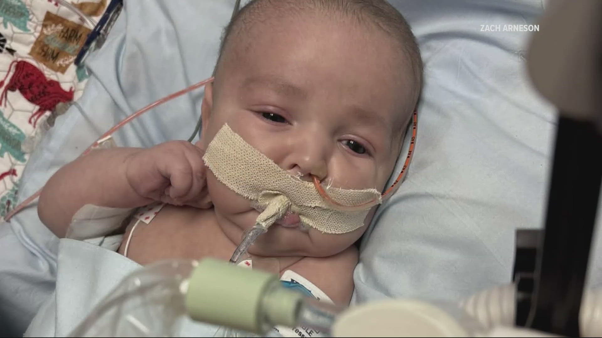 6-week-old baby with two rare medical conditions fighting for life at ...