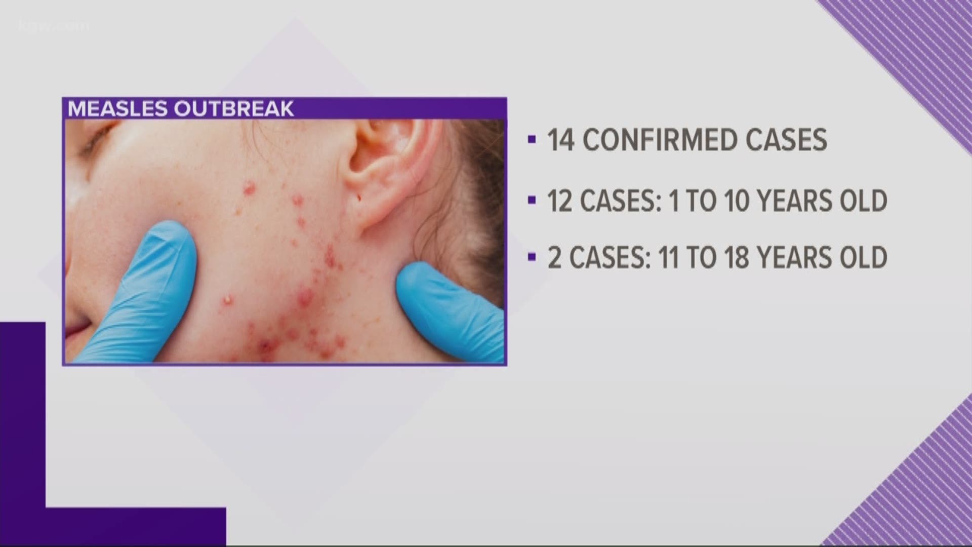 Measles outbreak in Clark County | kgw.com