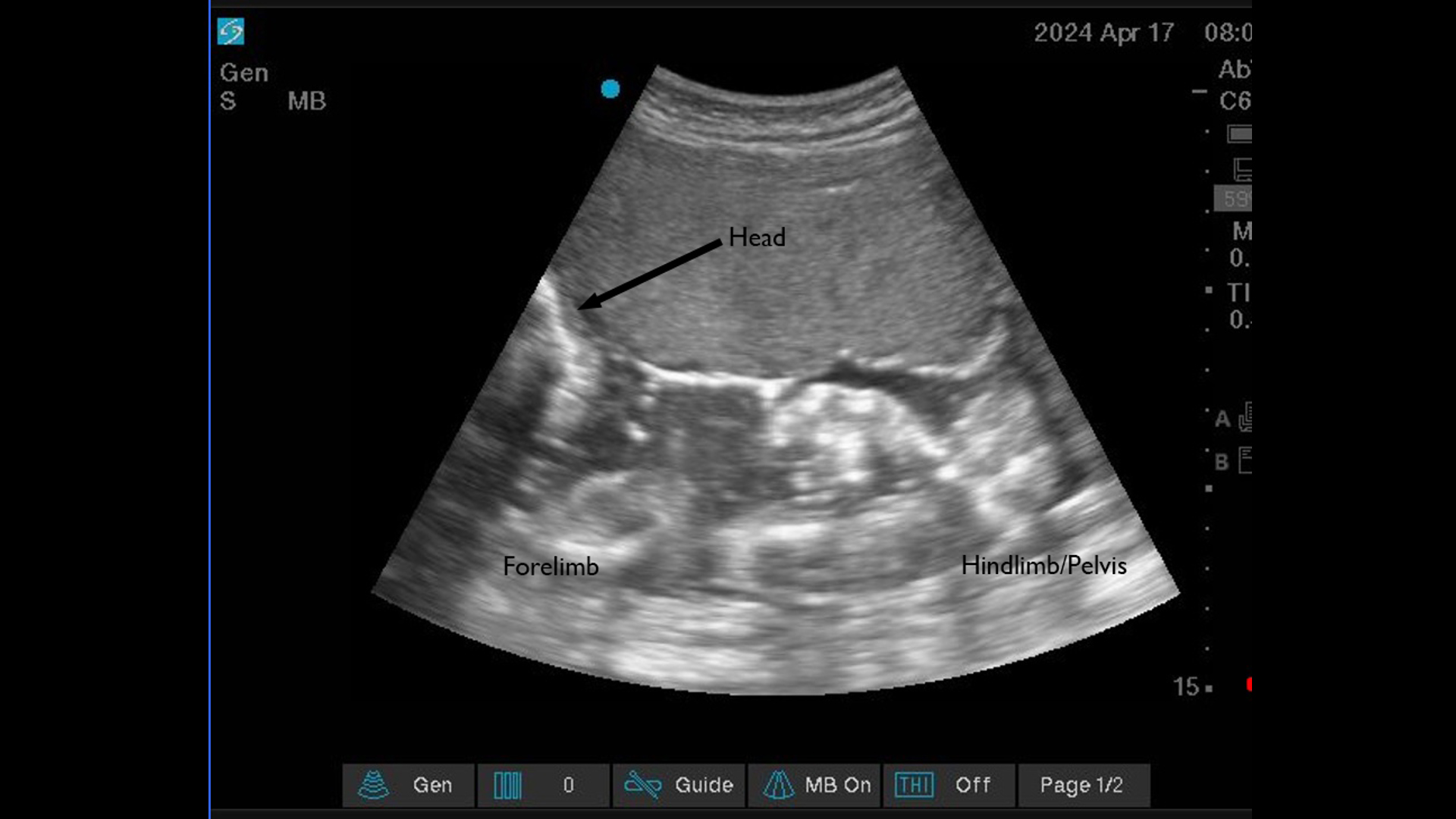 Woodland Park Zoo shares gorilla ultrasound photos, video | kgw.com
