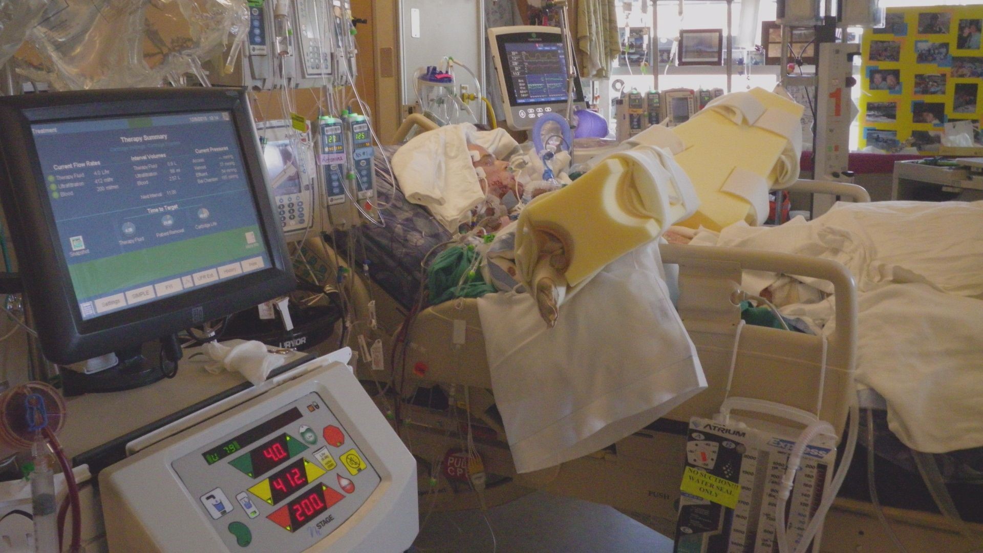 Man makes miraculous recovery after preventable inferno burns 90 ...